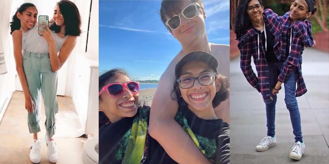 “We share the same geπit@ls, but only one of us has a boyfriend” – Conjoined twins open up about ...